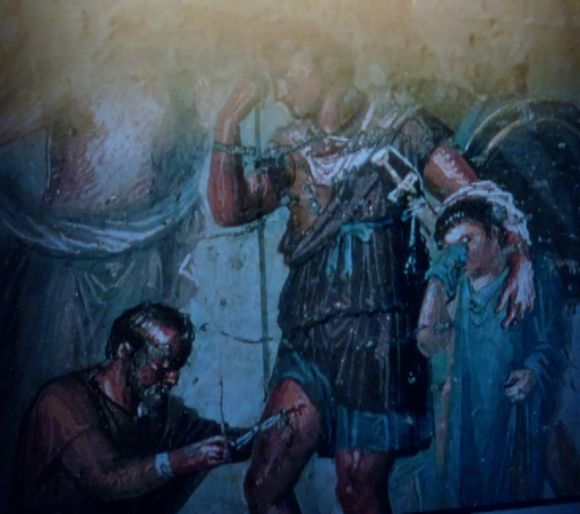 Ancient Rome: Healthcare